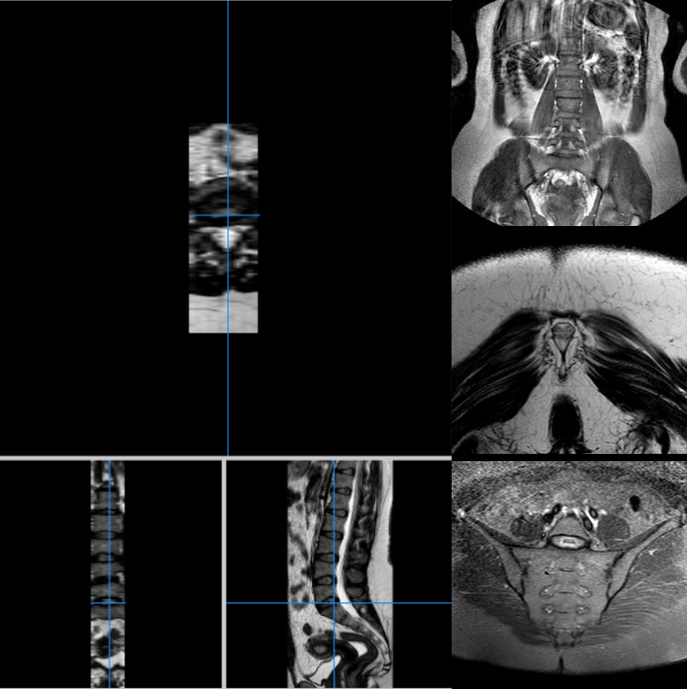GitHub - UniData-pro/Lumbar-Spine-MRI: Lumbar spine MRI dataset: high-quality imaging of ...
